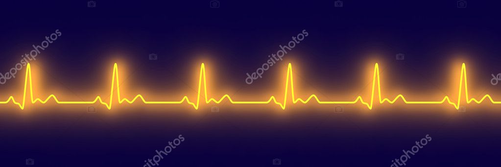 Pulse trace Stock Photos, Royalty Free Pulse trace Images | Depositphotos