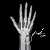 Zlomené kosti v lidské ruce — Stock Vektor © interactimages #115173404