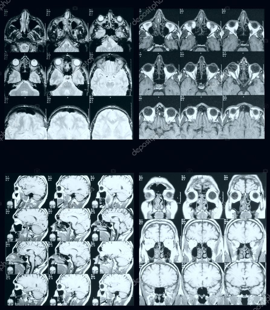 MRT Stock Photo by ©Sergieiev 2879409